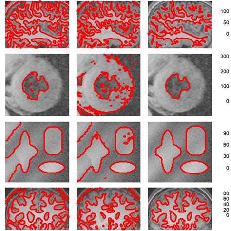 Comparisons With Local Active Contour Model Using A Synthetic Image And