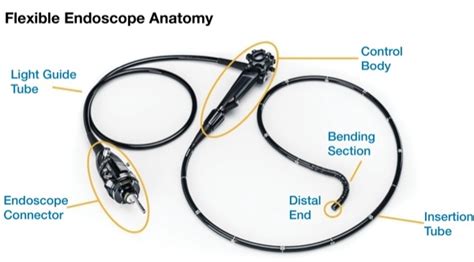 Colonoscopy Scope Size