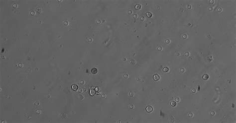 中 과학자들 줄기세포로 쥐 정자 생산무정자증 남성 불임 치료 희망