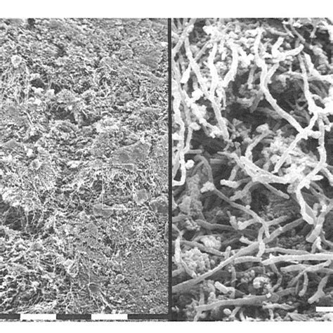 Root Surface Of Untreated Control Specimen Featuring A Thick Mat Of