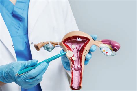 자궁근종 더미즈병원