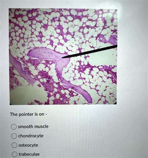 The Pointer Is On Smooth Muscle Chondrocyte Osteocyte Trabeculae The