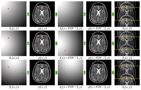 A Support Based Reconstruction For Sense Mri