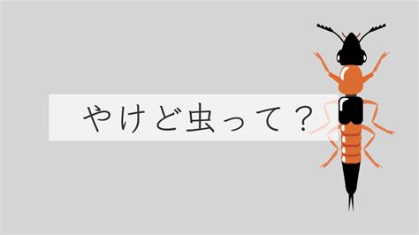 【虫刺され】『ダニ』に刺されたらどうすればいい？症状と具体的な対策を現役皮膚科医がわかりやすく解説【イエダニ、マダニ、跡を残さない】 医療
