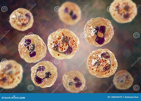 Meningococcal Meningitis Cerebrospinal Fluid Smear Royalty Free Stock