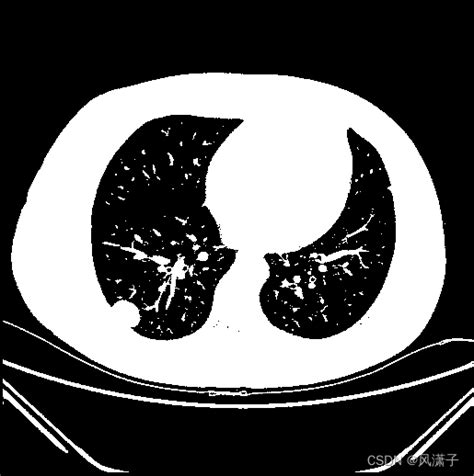 肺实质分割 csdn博客