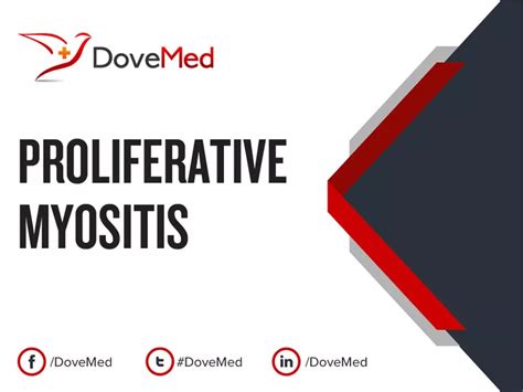How Well Do You Know Proliferative Myositis Dovemed