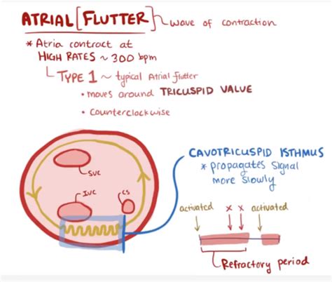 Cardiology Atrial Flutter Flashcards Quizlet