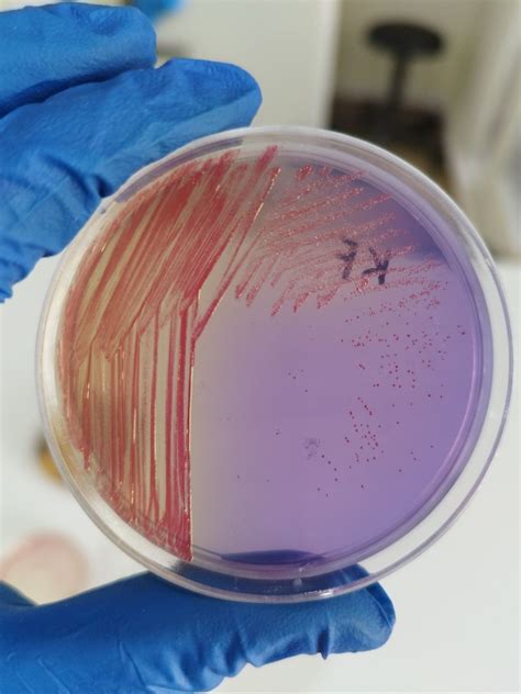 Zahra Zarei On Linkedin Enterococcus Faecalis On Kenner Fecal Agar And
