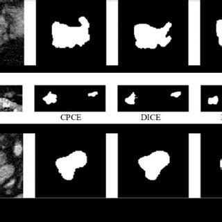 Overview Of The Ring Residual Model Download Scientific Diagram