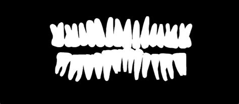 SerdarHelli SegmentationOfTeethPanoramicXRayImages Datasets At