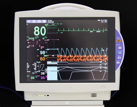 What Is An ECG Electrode With Pictures