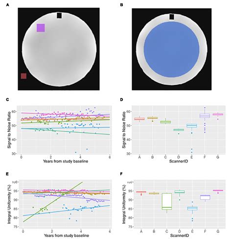 Figure 1 From Reproducibility Of Structural And Diffusion Tensor Imaging In The Tacern Multi