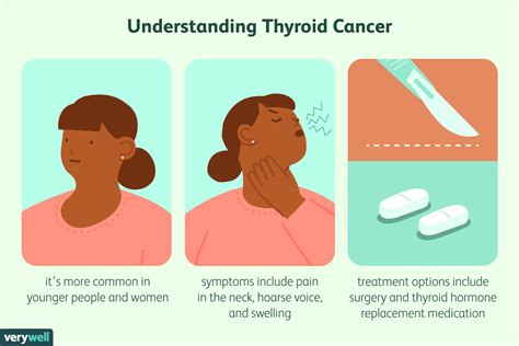 Thyroid Cancer Overview And More
