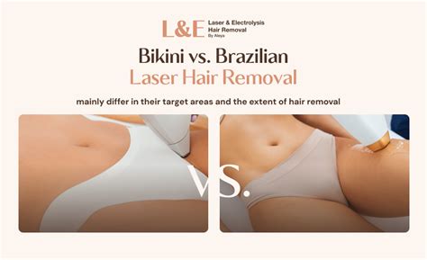 How Much Does Laser Hair Removal Cost In 2024 New Prices