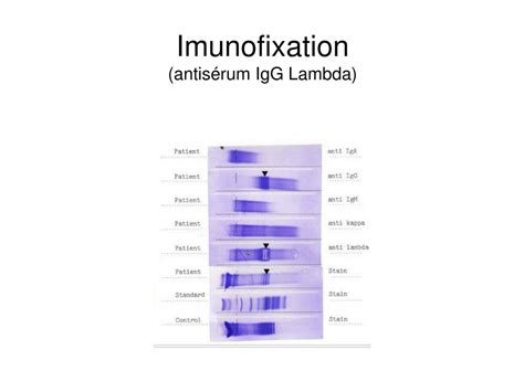 Ppt Immune Response Against Tumors Powerpoint Presentation Free