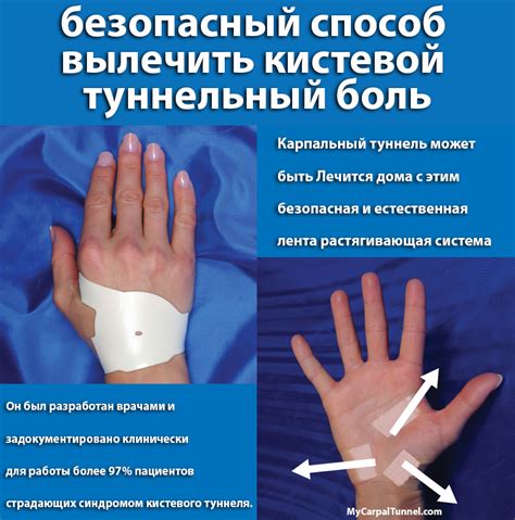 Диета При Туннельном Синдроме — Похудение Диета Правильное Питание