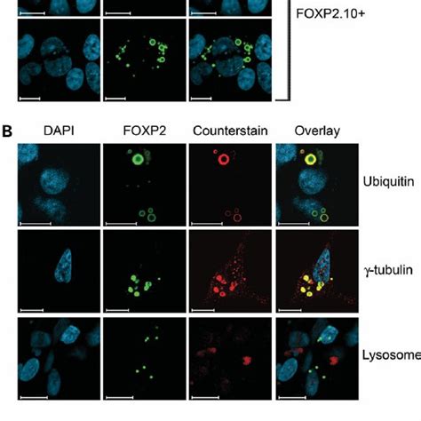 Expression Of Recombinant Foxp2 A Schematic Representation Of The