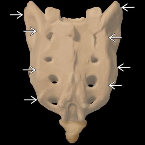 Sacroiliac Joint Injection Clinical Tree