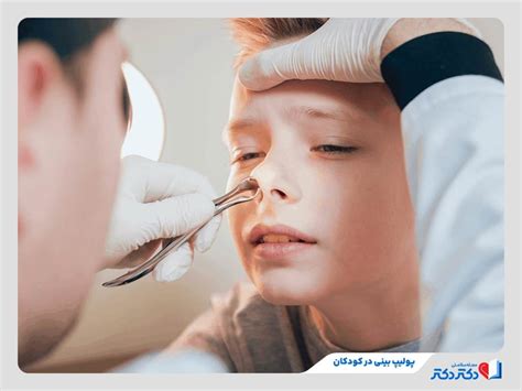 پولیپ بینی در کودکان علل، علائم، روش‌های پیشگیری و درمان