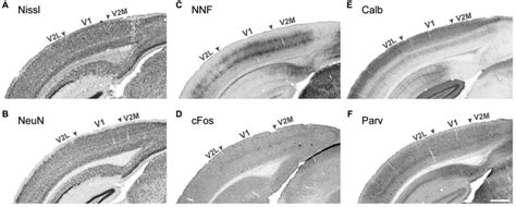 Demarcation Of The Primary And Secondary Visual Areas In The Mouse