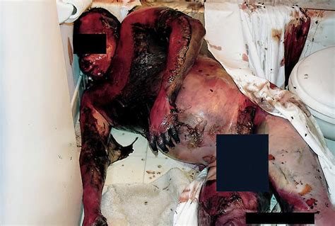 Advanced Stages Of Decomposition R NSFL