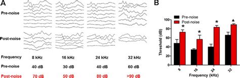 Hearing Thresholds And Representative Abr Waveforms At Different