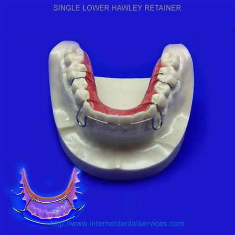 Class 3 Mod 1 Rpd Design Carliekruwstokes