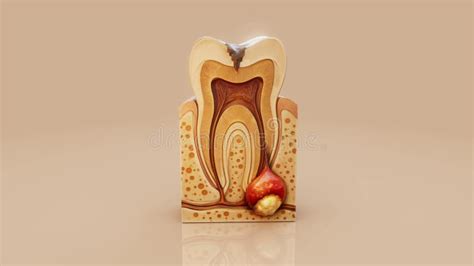 Hygiene Abscess Stock Illustrations 603 Hygiene Abscess Stock