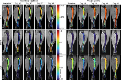 Quantitative Mri Metrics Show Regional Variations In Disease Download Scientific Diagram