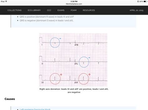 Endocrine Flashcards Quizlet