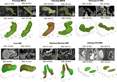 Figure 1 From 3d Deep Learning For Anatomical Structure Segmentation In Multiple Imaging