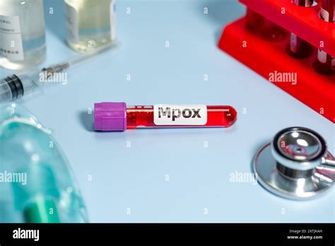 Blood Collection Tubes Mpox Test Positive Results WHO To Rename Monkeypox As Mpox Stock Photo