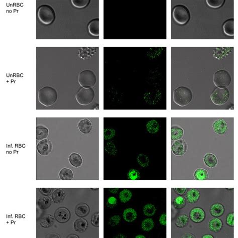 Localization Using Confocal Microscopy Bright Field Fluorescence And Download Scientific