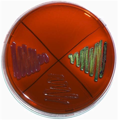 Lab 23 Ex 4 6 Eosin Methylene Blue Emb Agar Flashcards Quizlet