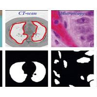 FCM With CNN For Segmentation Download Scientific Diagram