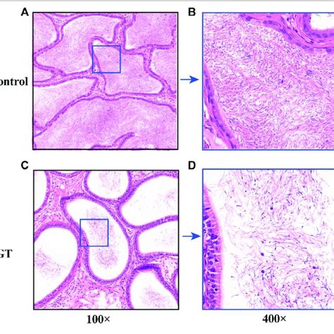 A Epididymis Pathology In The Control Group ×100 B Epididymis Download Scientific