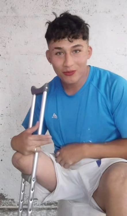 1 Legged Guy Shows Stump Tumbex