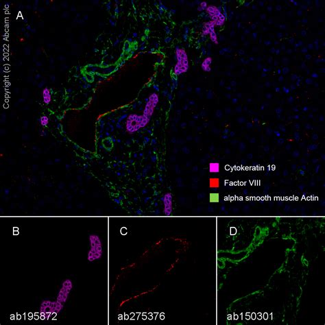 Results For Alpha Smooth Muscle Actin Abcam Antibodies Proteins Kits