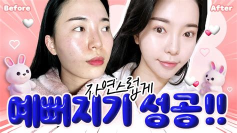 이모에서 언니로🥰 윤곽귀족눈재수술 폼 미쳤다 성형전후 성형브이로그 Youtube