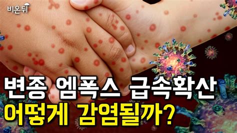 비상사태 선언 제 2의 코로나 변이 엠폭스는 어떻게 감염될까 Youtube