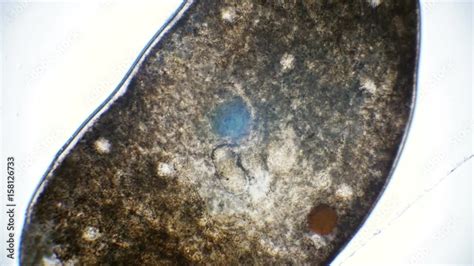 Body Of A Living Leech Worm Under The Microscope Stock Video Adobe Stock