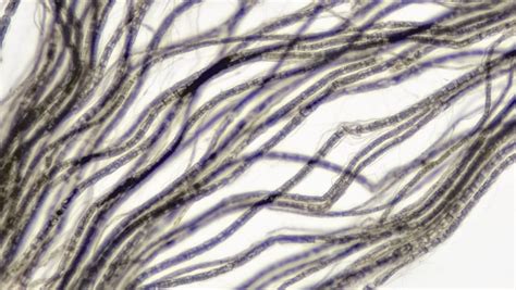 Lumbar Plexus Anatomy Quiz