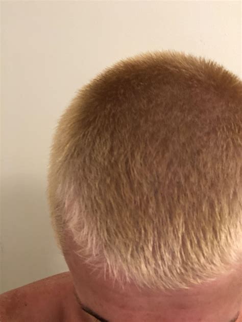 Bleach Hair Gone Ginger At Sara Gardner Blog