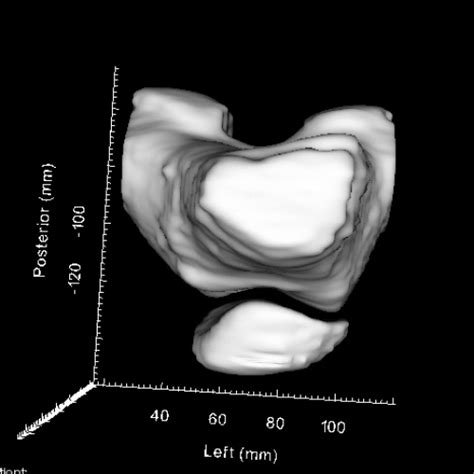 Trochlear Groove1 500×500 Qmetrics Technologies