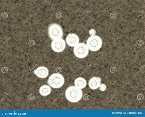 Cryptococcus In Peripheral Blood Smear Gram Stain Royalty Free Stock Cryptococcus In Peripheral Blood Smear Gram Stain Royalty Free Stock
