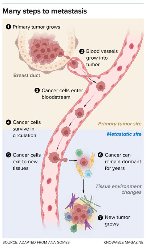 Metastasis Diagram