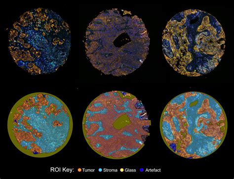 spatial phenotyping in digital pathology defining a multiplex if image