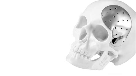 Cranial Reconstruction Tecumed Sro Cranial Reconstruction Tecumed Sro