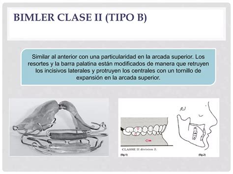 Aparato Ortopédico De Bimler Pptx